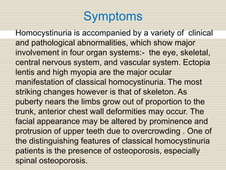 Homocystinuria | PPTX