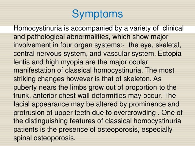 Homocystinuria