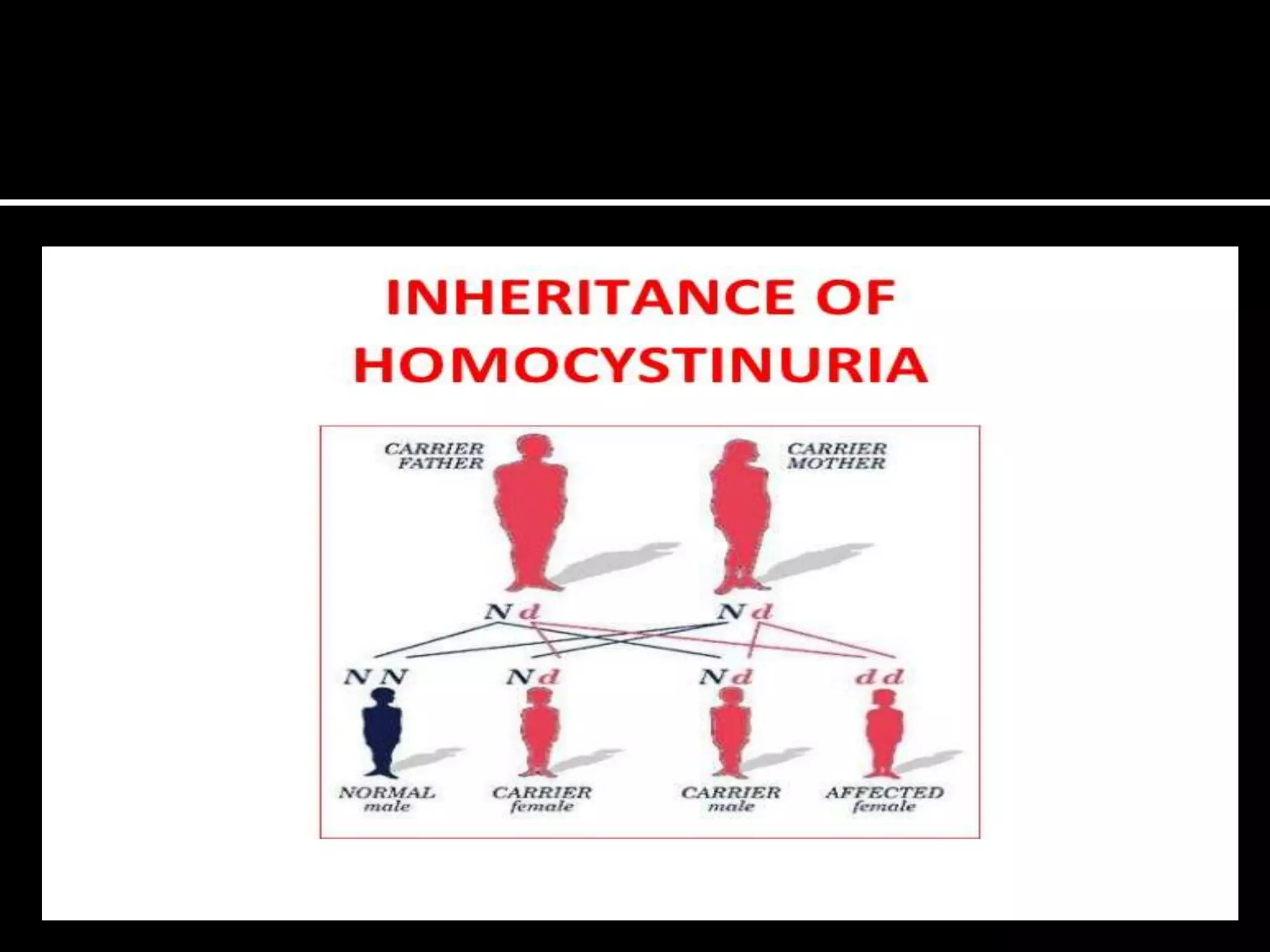 Homocystinuria copy | PPTX