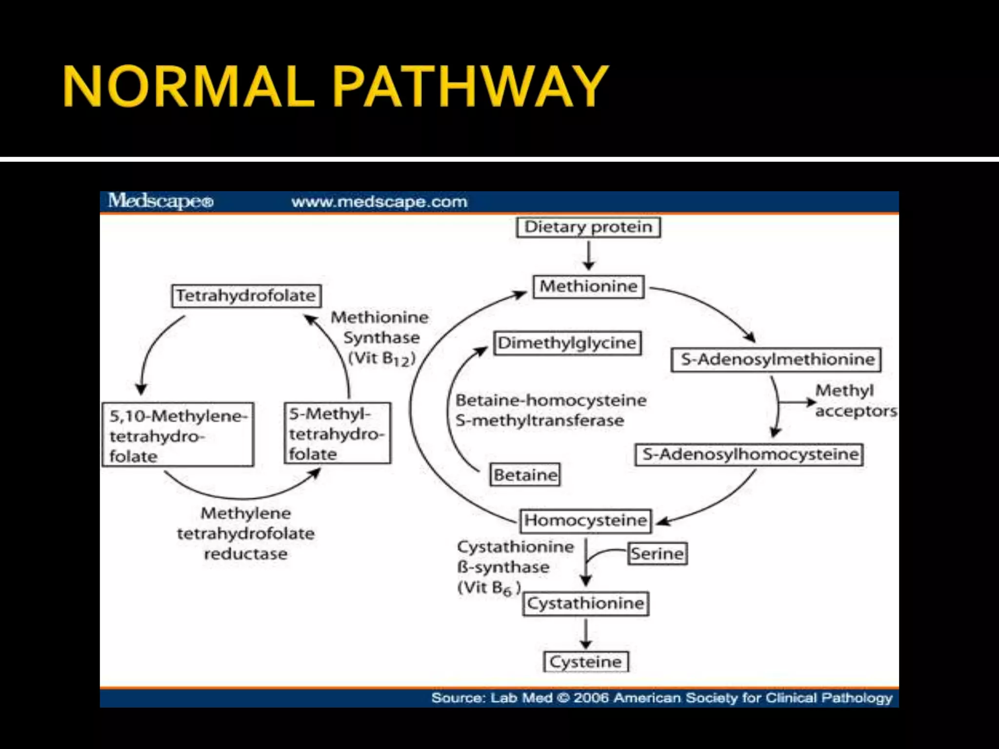 Homocystinuria copy | PPTX