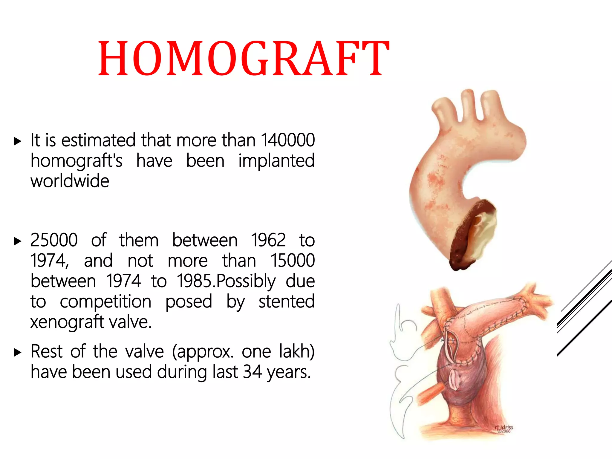 Homografts in cardiac surgery | PPT