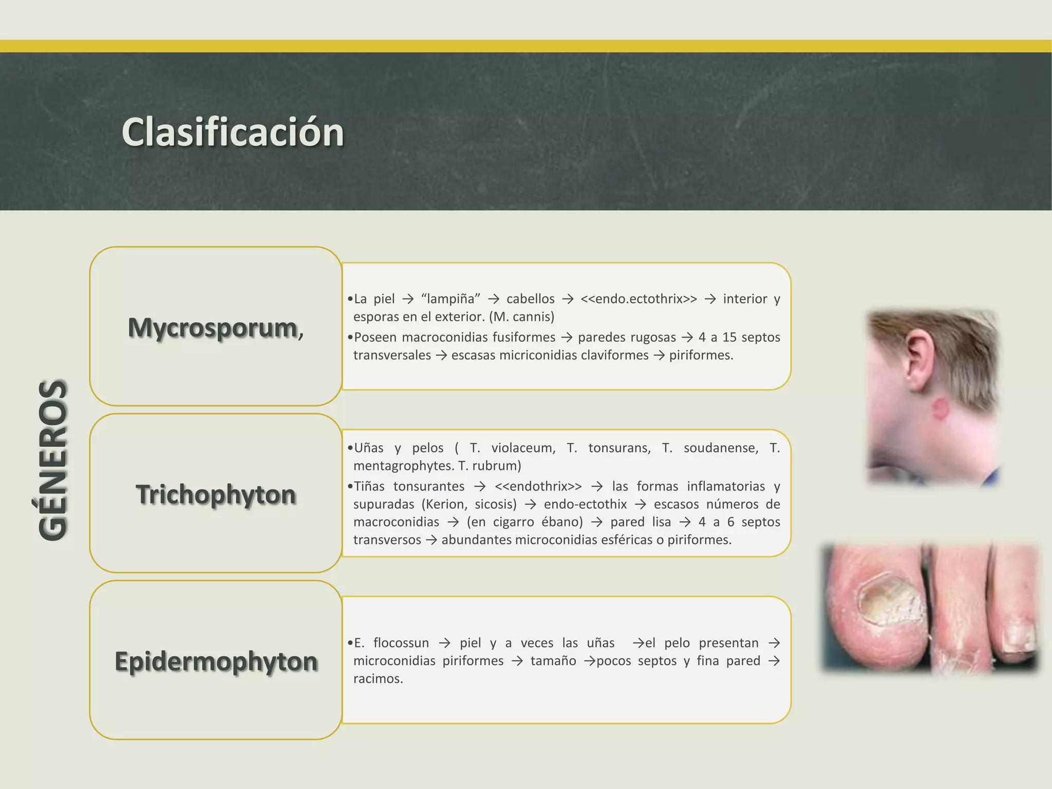 Dermatofitosis - Hongos | PPTX