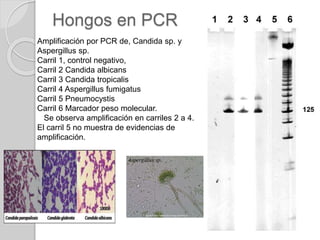 Hongos en Pcr | PPTX