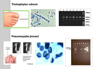 Hongos en Pcr | PPTX