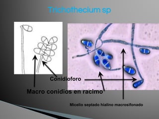 Hongos micromorfologia | PPT