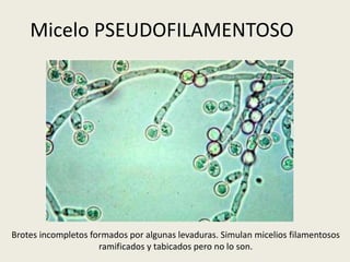 HONGOS: Generalidades, estructura y clasificación | PPTX