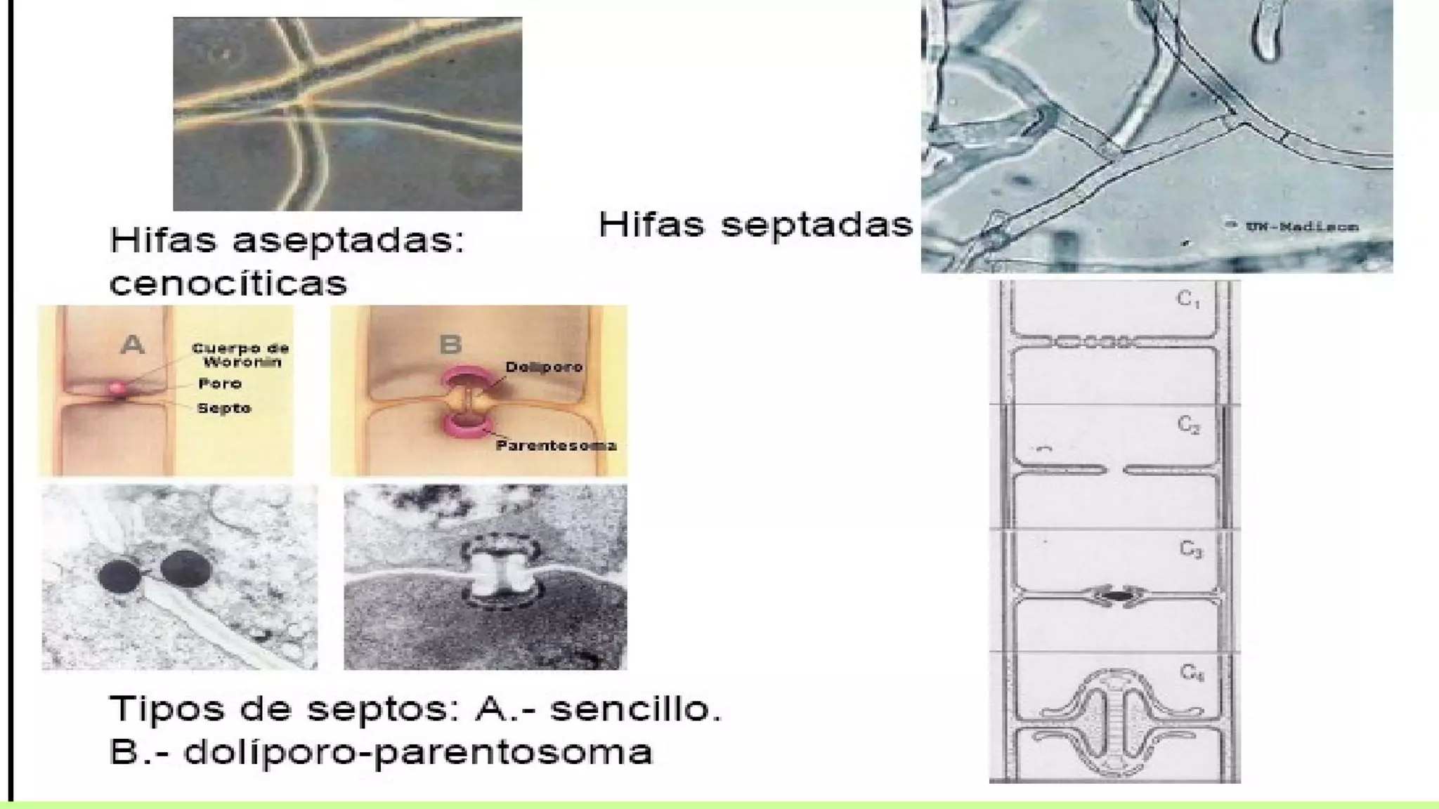 Hongos, caracteristicas generales,principales grupos,liquenes | PPT