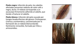 Hongos y micosis | PPTX