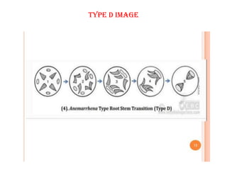 Root Stem Transition in Plant Body | PDF
