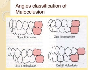 History Of Orthodontics | PPTX