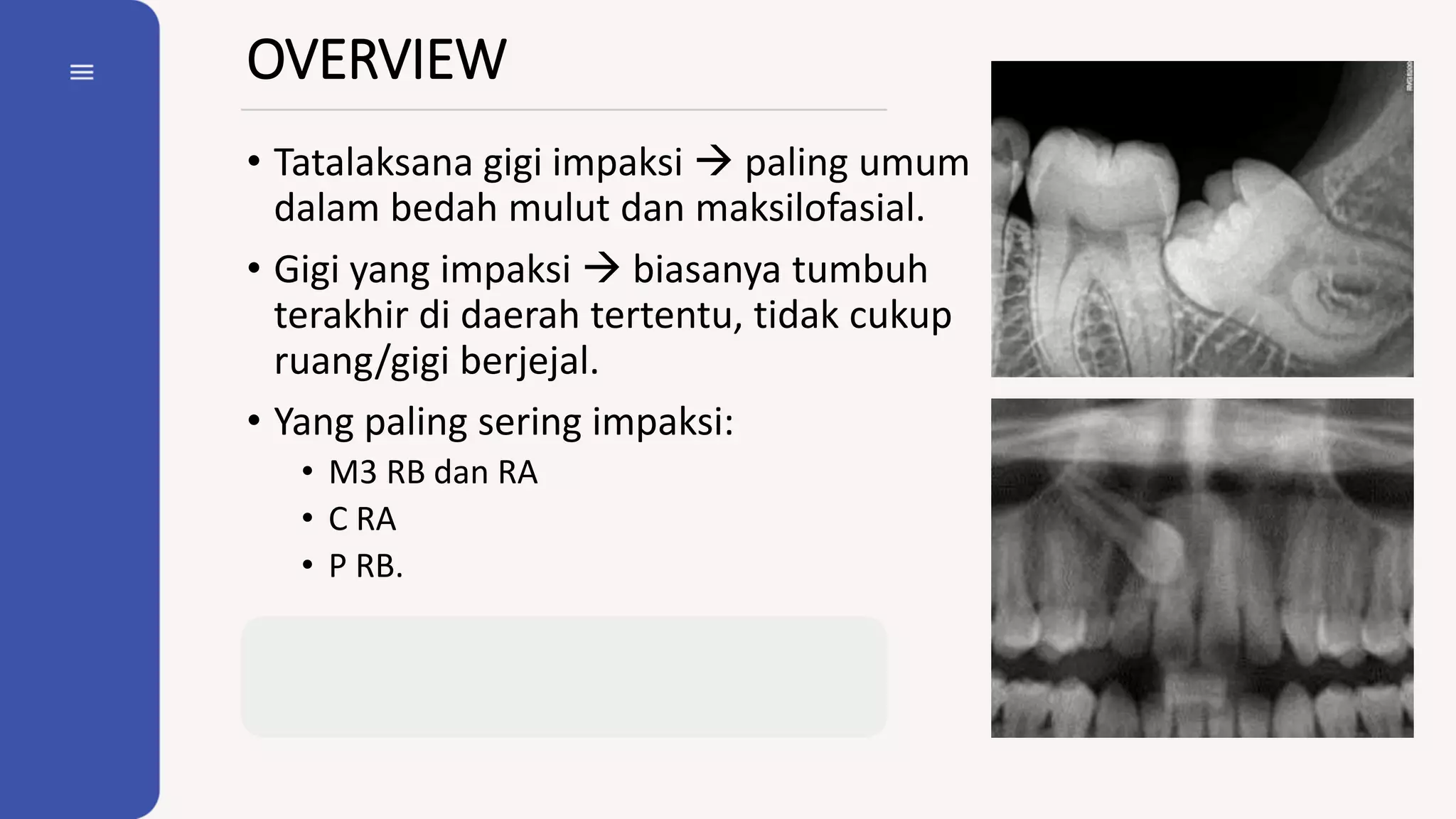 HO Odontektomi-1.pptx