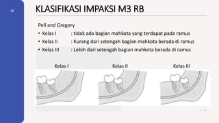 HO Odontektomi-1.pptx