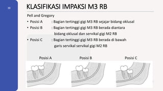 HO Odontektomi-1.pptx