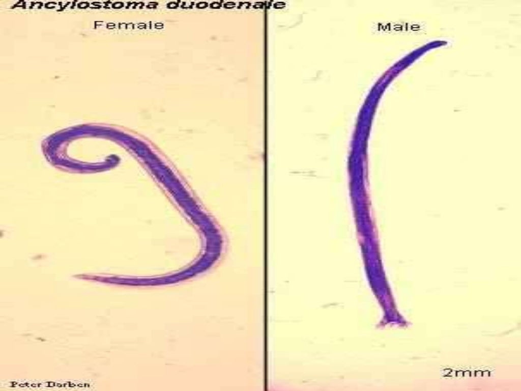 Hook worm