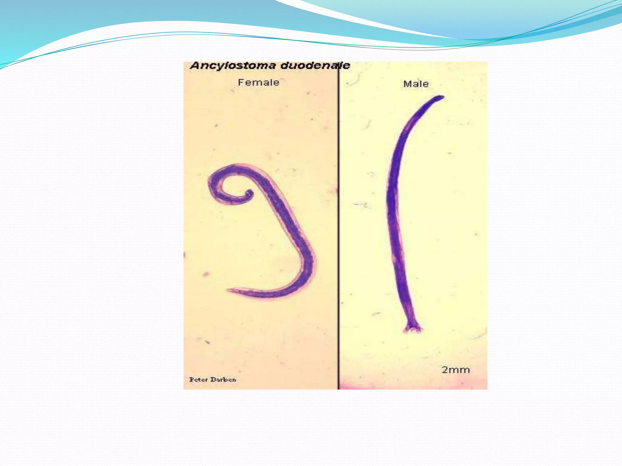 Hookworm Pptx