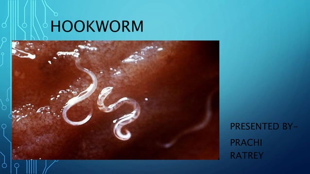 Hookworm introduction defination cause effect cure | PPTX | Infectious ...