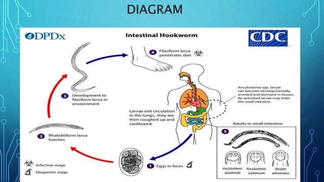 Hookworm introduction defination cause effect cure | PPTX | Infectious Diseases | Diseases and ...