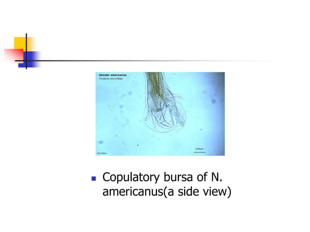 Parasitology Hookworm Pptx Slides 1 Ppt