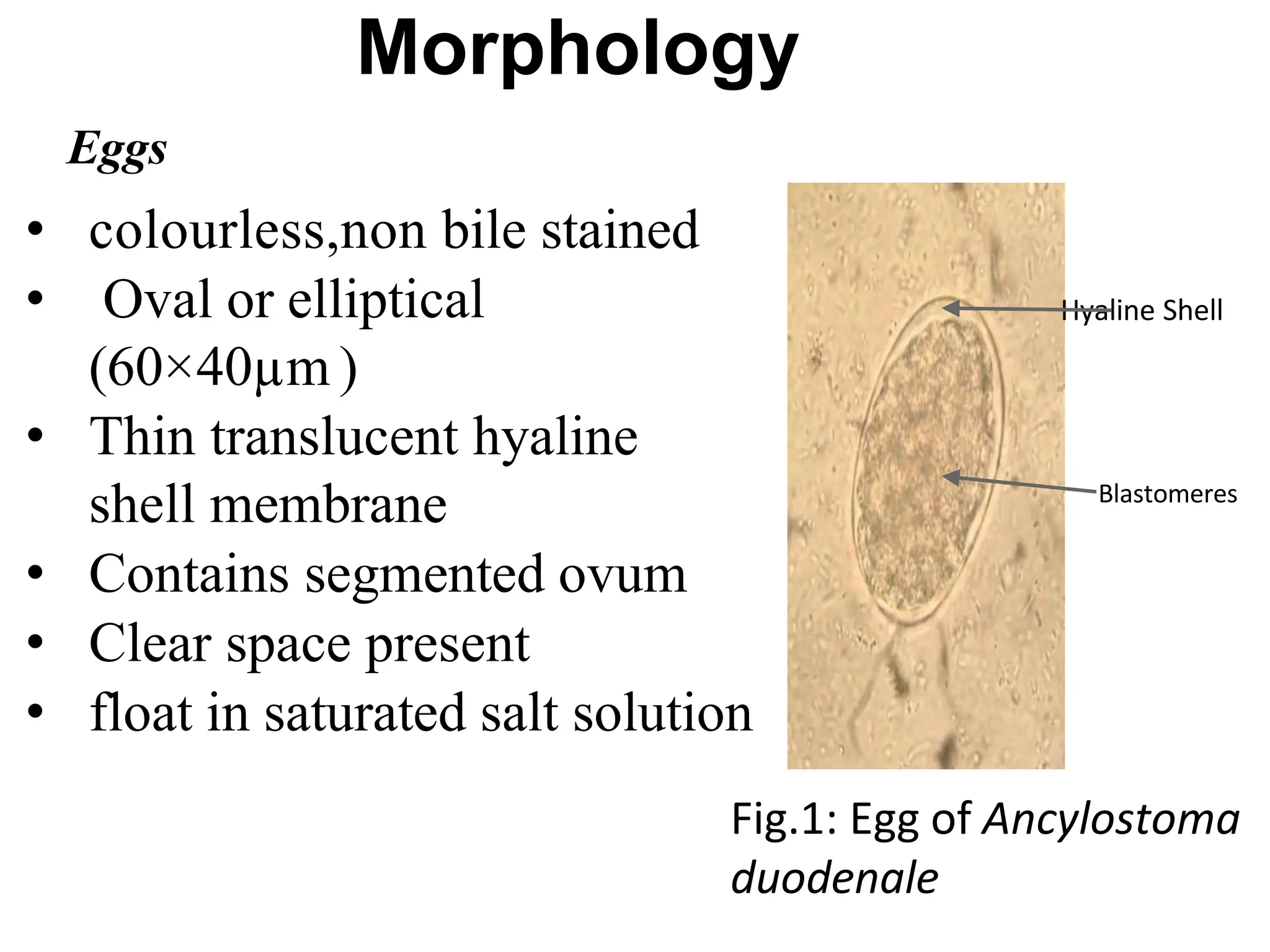Hookworm As A Part Of Worm Infestation And Common Helminths Pptx
