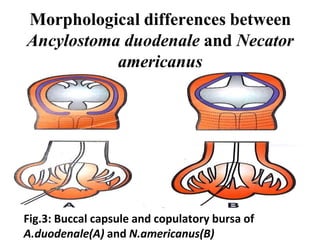 Hookworm as a part of worm infestation and common helminths | PPT