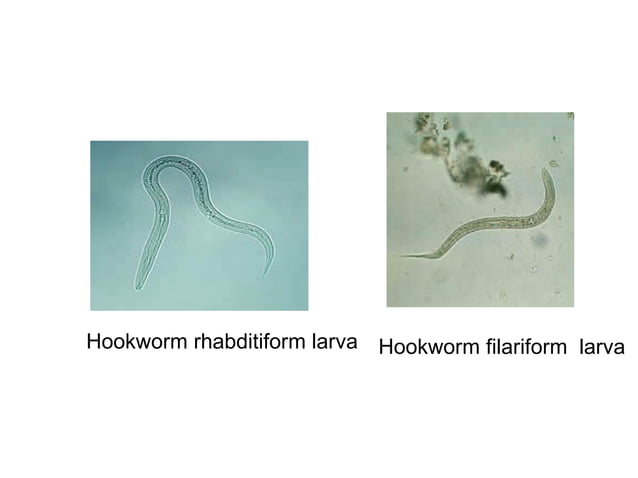 Hook worm and E. vermicularis,,,,,,,,,.ppt