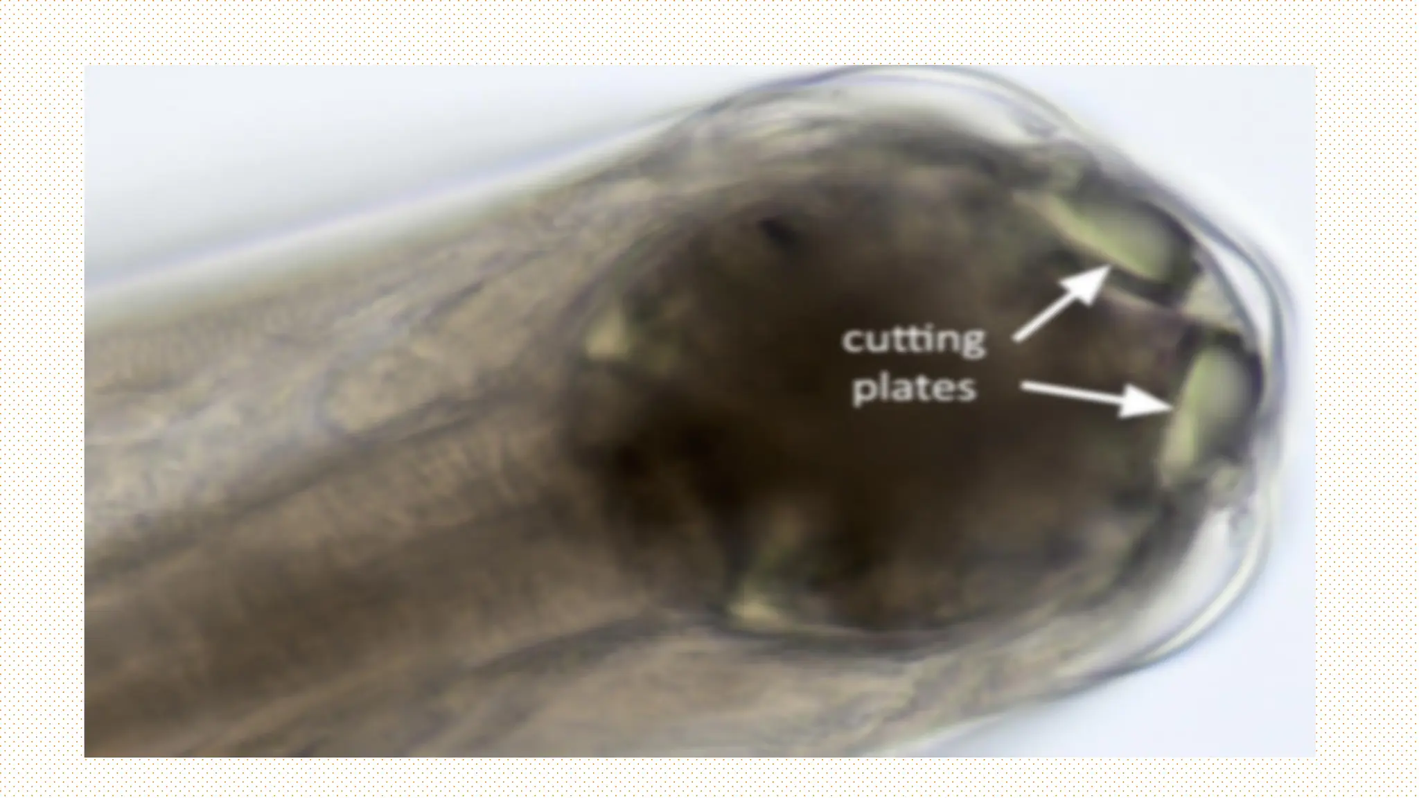 Slide to define about Hookworm infestation | PDF