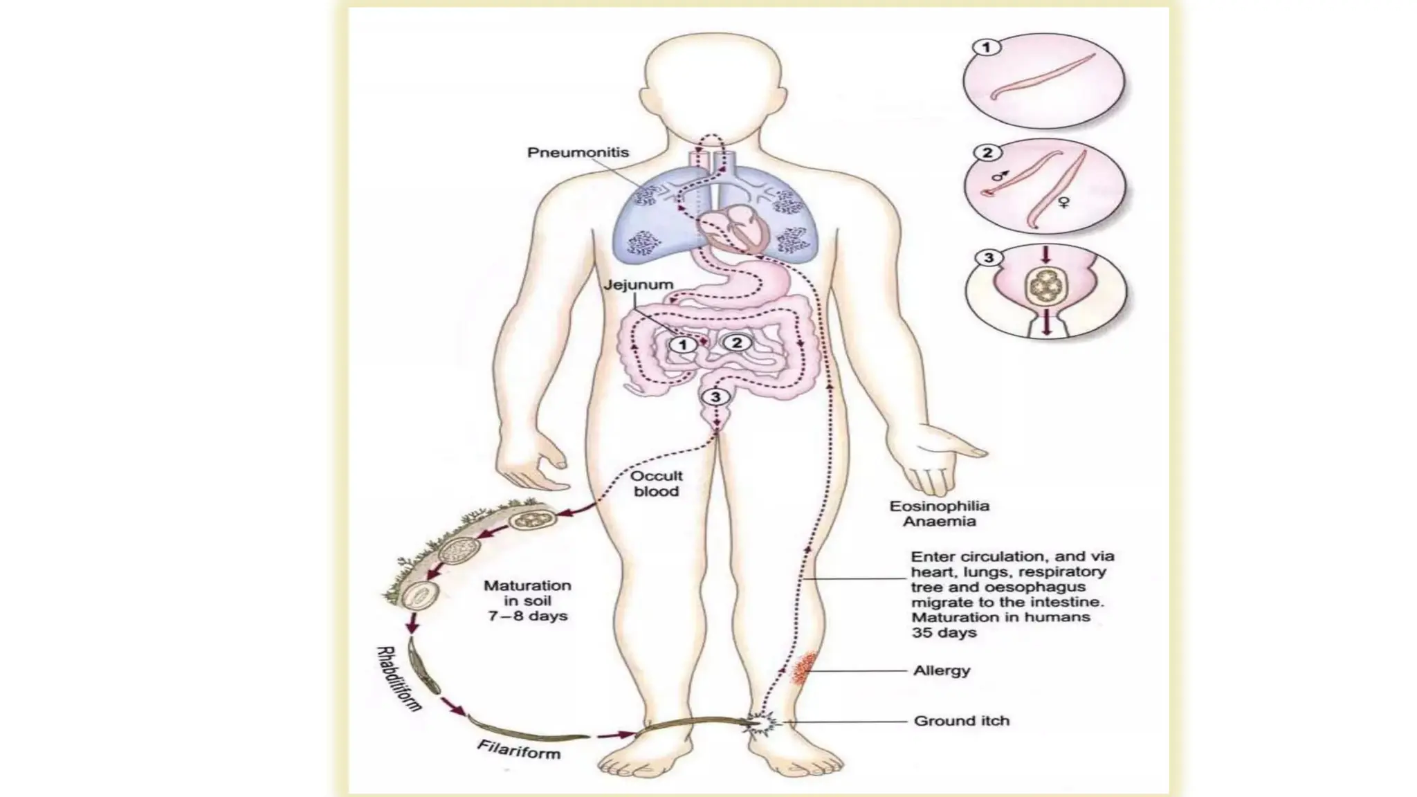 Slide To Define About Hookworm Infestation Pdf