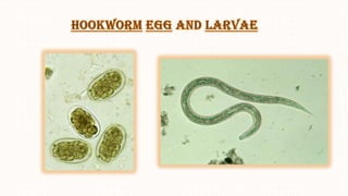 Slide to define about Hookworm infestation | PDF