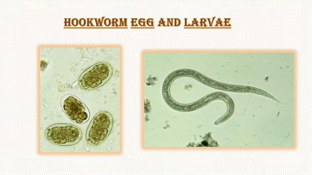 Slide to define about Hookworm infestation | PPT