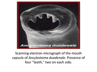 Hookworm presentation | PPTX