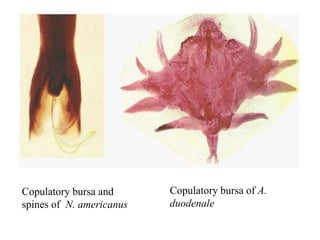 Hookworm presentation | PPTX