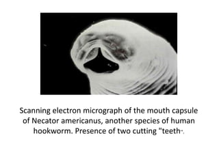 Hookworm presentation | PPTX