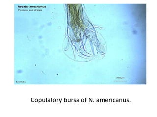 Hookworm presentation | PPTX