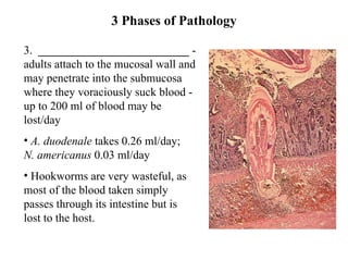 Hookworms | PPT