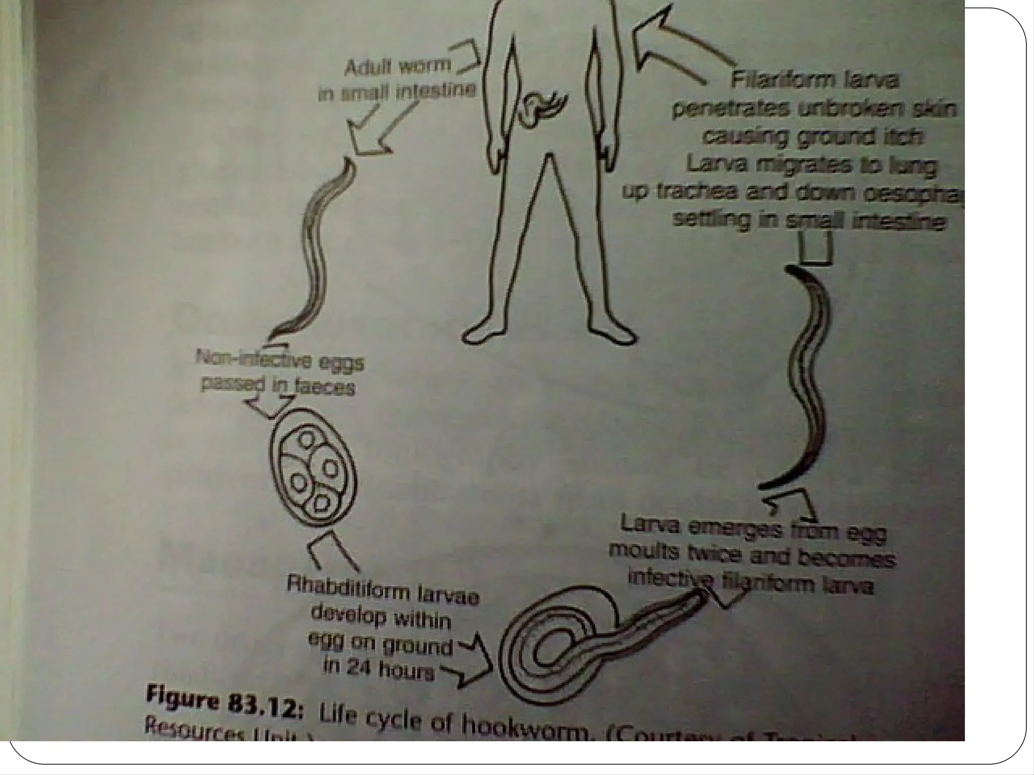 HOOK WORMS AND ASCARIASIS, medical Surgical Nursing course | PPTX