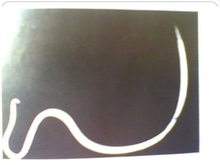 HOOK WORMS AND ASCARIASIS, medical Surgical Nursing course | PPT