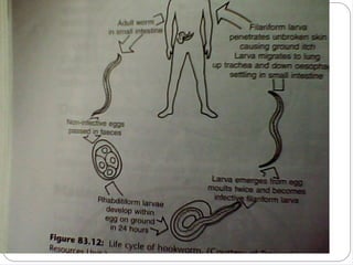 HOOK WORMS AND ASCARIASIS, medical Surgical Nursing course | PPTX