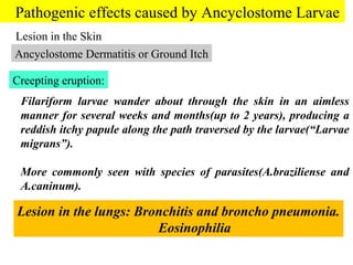 Hookworm infection | PPT
