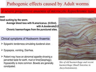 Hookworm infection | PPT