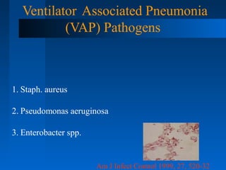HOPAK ANTIBIOTIC CHOICE IN ICU DR OKIKO ANDREW.ppt
