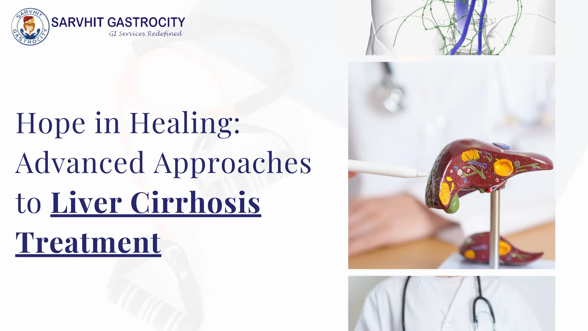 Hope in Healing Advanced Approaches to Liver Cirrhosis Treatment.pdf