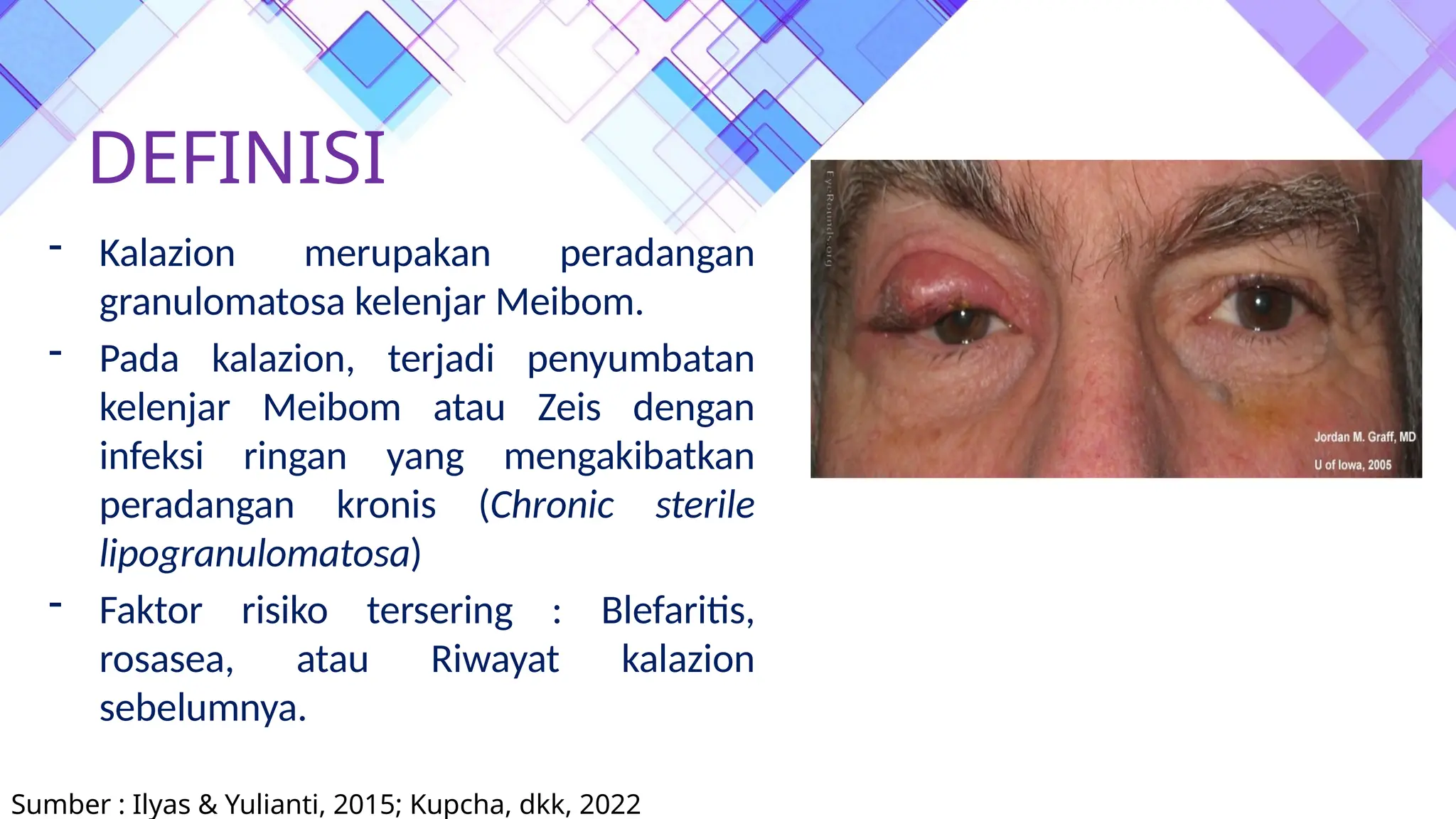 HORDEOLUM DAN KALAZION Tumor palpebra ppt.pptx