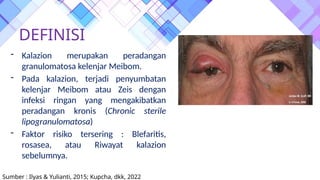 HORDEOLUM DAN KALAZION Tumor palpebra ppt.pptx