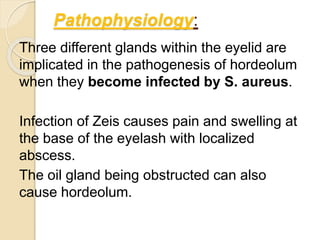 HORDEOLUM topic.pptx . | PPTX