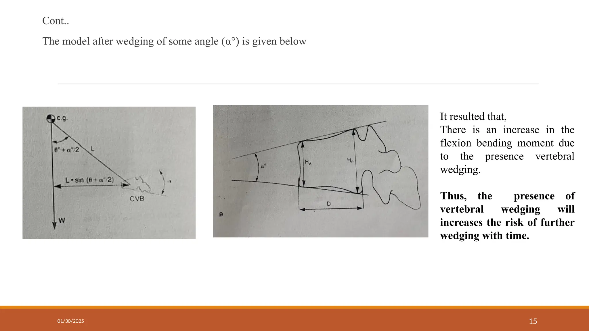 Biomechanical treatment approach for Scoliosis and Kyphosis and its ...
