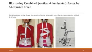 Biomechanical treatment approach for Scoliosis and Kyphosis and its ...