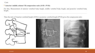 Biomechanical treatment approach for Scoliosis and Kyphosis and its ...
