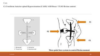 Biomechanical treatment approach for Scoliosis and Kyphosis and its ...