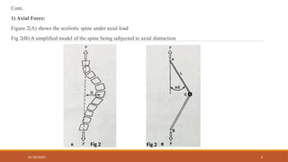 Biomechanical treatment approach for Scoliosis and Kyphosis and its ...
