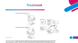 Horizontal Canal BPPV and Other Positional Vertigos | PPTX